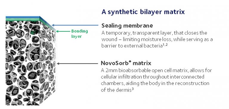 What is NovoSorb® BTM?