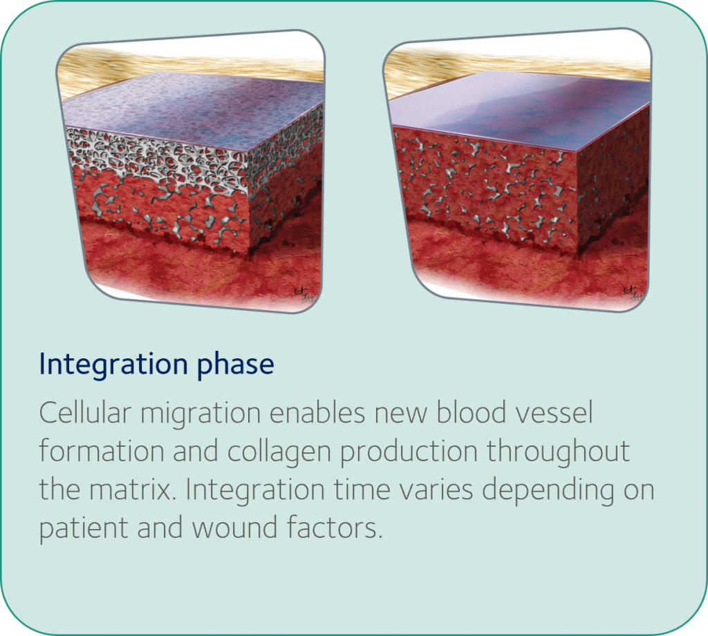 Application to Delamination with NovoSorb® BTM