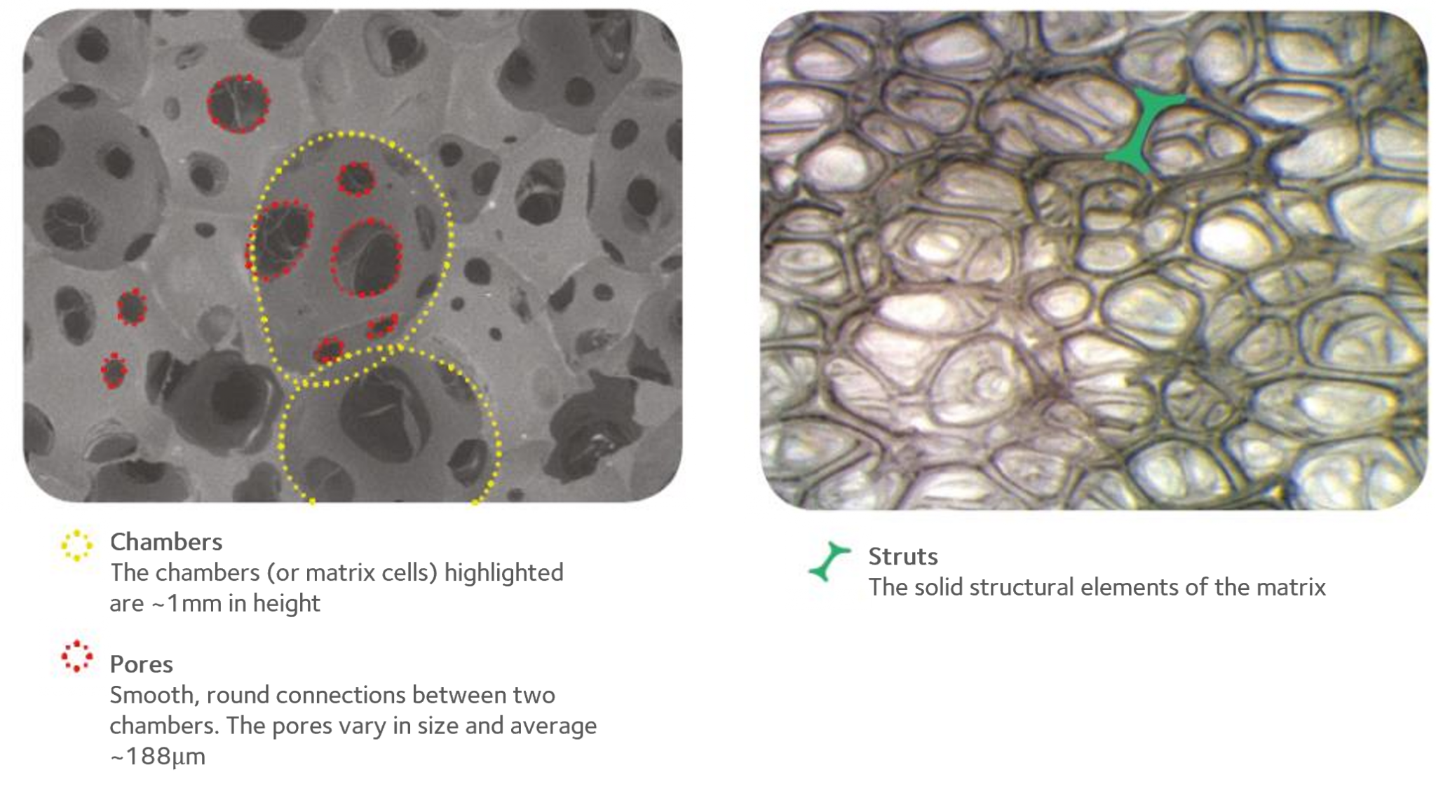 How Does NovoSorb® BTM Convert Repair into Regeneration?